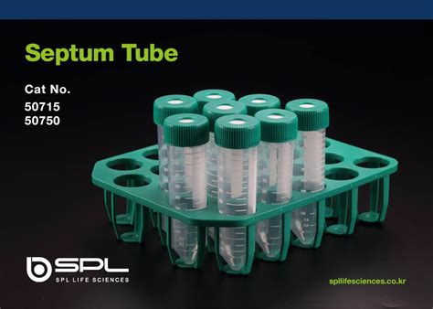 Miguel Marrero On Linkedin For The Laboratories That Need Clean Pbmc