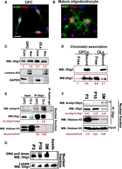 Olig1 Acetylation And Nuclear Export Mediate Oligodendrocyte