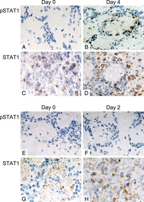 Local Type I Ifn Receptor Signaling Protects Against Virus Spread
