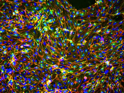 When A Network Matters Functional Ipsc Derived Endothelial Cells