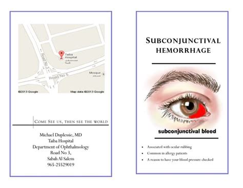 Subconjunctival Hemorrhage By Dr Michael Duplessie Eye Doctor Pdf