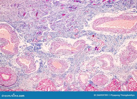 Characteristics Tissue Of Olfactory Epithelium Human Under The