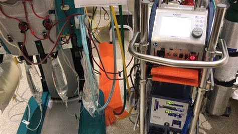 Crrt And Ecls Ecmo Resource A Space For Ecmo Specialists And Their Interdisciplinary Ecmo