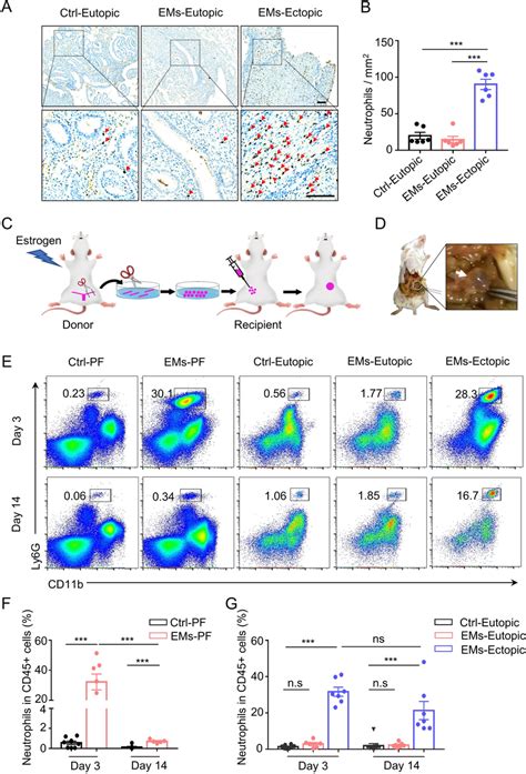 Enrichment Of Neutrophils To Ectopic Lesions A Representative Mpo Download Scientific Diagram
