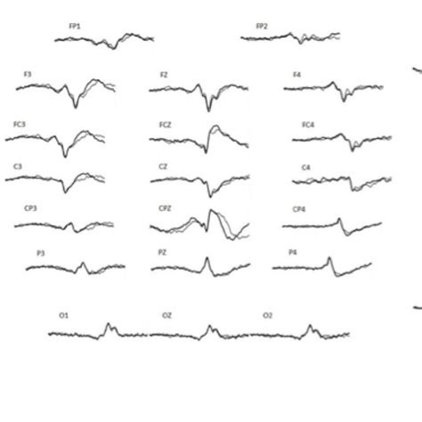 Erp Grand Average Waveforms Of 30 Electrodes Recorded During Correct