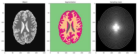 Mri Imaging And Segmentation Of Brain — Pyproximal