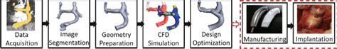 schematic workflow diagram of the virtual fontan design optimization