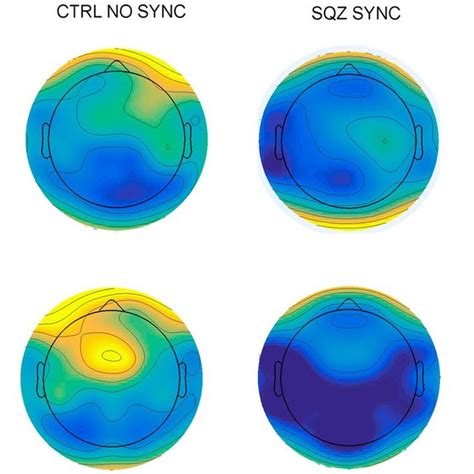 Higuchi Fractal Dimension Complexity Differences Between Full And Mw Download Scientific