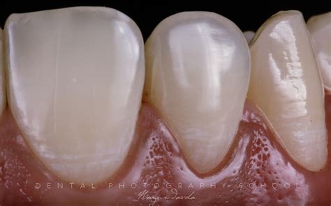 Dental Photography Article Dr Mayur Davda