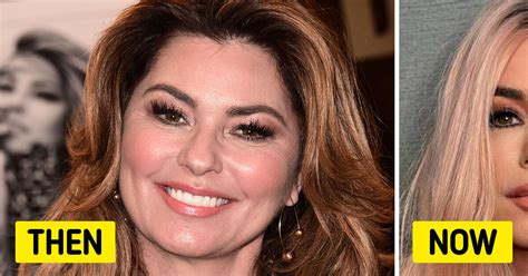 Shania Twain Deemed Unrecognizable After Her Face Shocked People In New