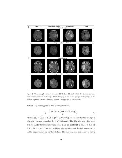 Deep Learning Automates Bidimensional And Volumetric Tumor Burden