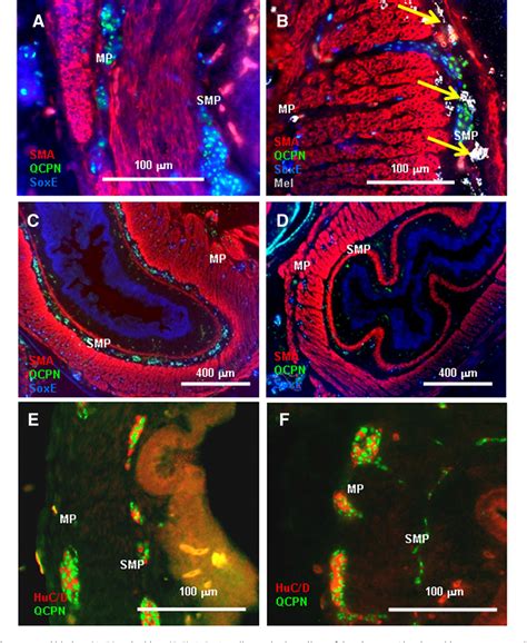 Figure 1 From Neural Crest Regionalisation For Enteric Nervous System