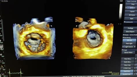 Konstantinos Papadopoulos Eacvi Education Committee Md Phd Fesc