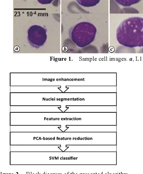 Figure 1 From Automatic Recognition Of Acute Lymphoblastic Leukemia Using Multi Svm Classifier