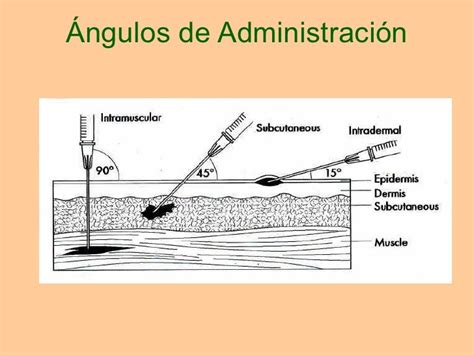 Salud 4 Tipos Y Formas De Dar Inyecciones Interuniversidades