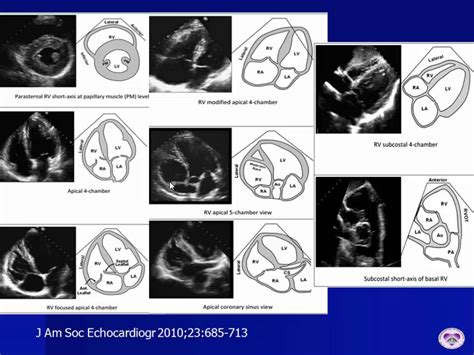 Rv Dimensions On Echo At Johnnie Hart Blog