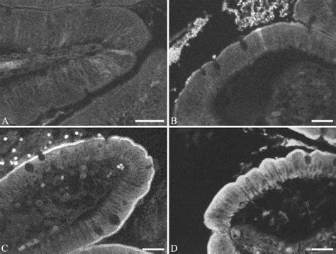 Light Microscopy Direct Detection Of Fitc In Duodenal Tissue Before