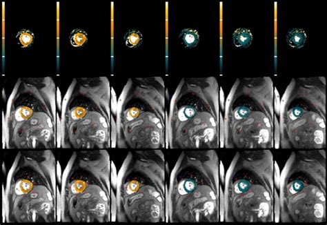Alternate Institution Example Result Comparison Of Automated And Download Scientific Diagram