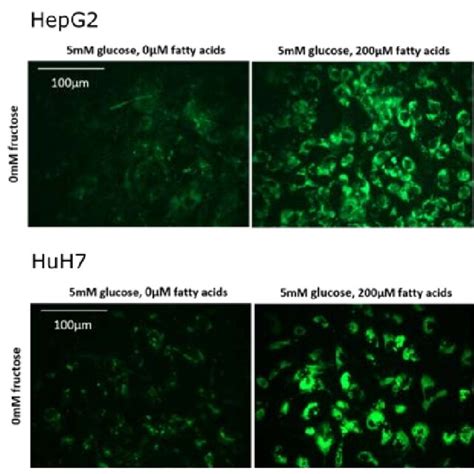 Effect Of Fatty Acids On Lipid Accumulation In In Different Cell Types