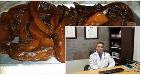 მექსიკელმა ექიმმა აღმოაჩინა წამალი რომელიც მხედველობასა და მეხსიერებას 80 ით აუმჯობესებს