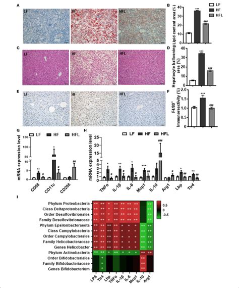Lentinan Prevented Hf Diet Induced Hepatic Lipid Deposition