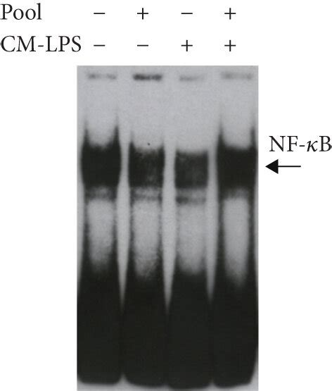 Effect Of Antioxidants On Neuronal Nf κb Binding Activity A D Emsa