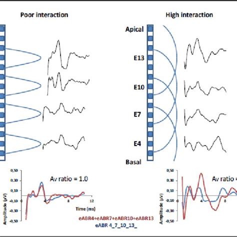 Abr Waveforms And Recoding Electrodes Placement 18 Download