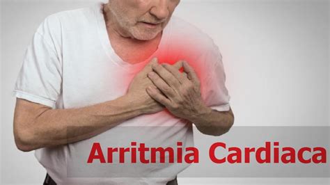 Cuales son los Síntomas de las Arritmias Cardíacas YouTube