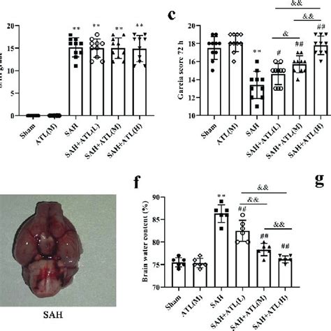 Effects Of Atl On Neurologic Deficits Brain Edema And Bbb Disruption