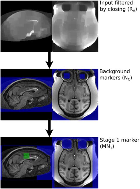 Frontiers Brain Extraction Using The Watershed Transform From Markers