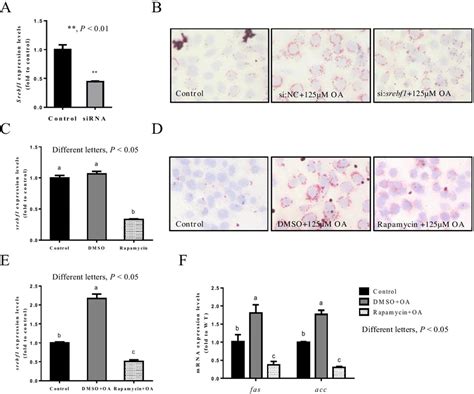 Srebf1 Silent Rapamycin Treatment Reduced Lipid Deposition Which Was