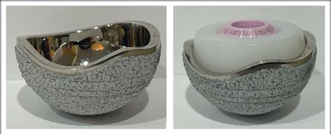 Figure 1 From Use Of A Monoblock Dual Mobility Acetabular Component In