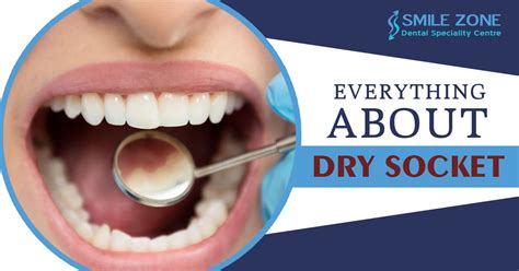 Dry Sockets In Teeth