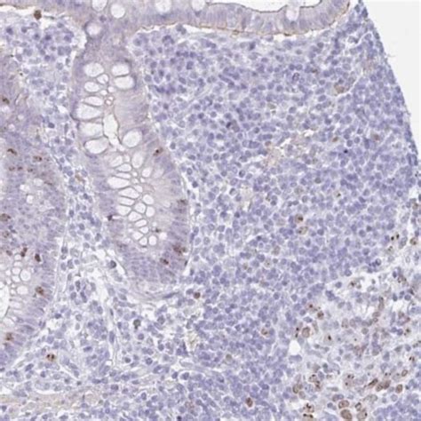 Suz12 Antibody Novus Biologicals 0 1ml Unlabeled Antibodies