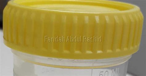 Medicine Newbie Infection And Antibiotics Tazocin