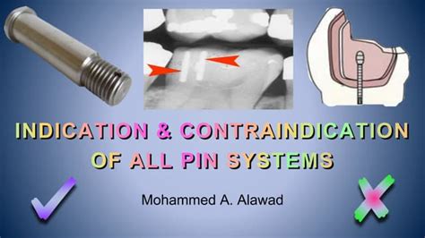 Indications And Contraindications Of Retentive Pins Ppt