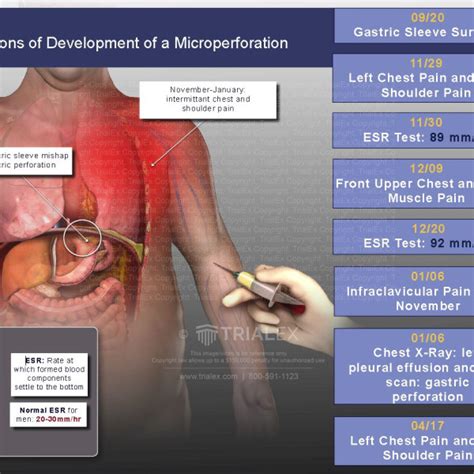 Medical Legal Exhibits Legal Animations And Trial Graphics