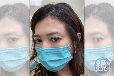 廖家儀為最新八點檔返台車禍 「遭後方推撞」臉部傷勢曝光 鏡週刊 Mirror Media