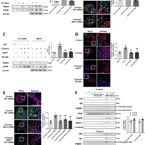 Glucocorticoid Triggers Aβ Accumulation At Mitochondria By Enhancing