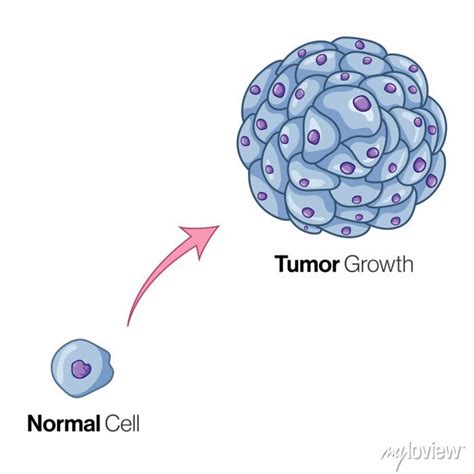 Tumor Growth From Normal Cell Illustration • Wall Stickers Abstract