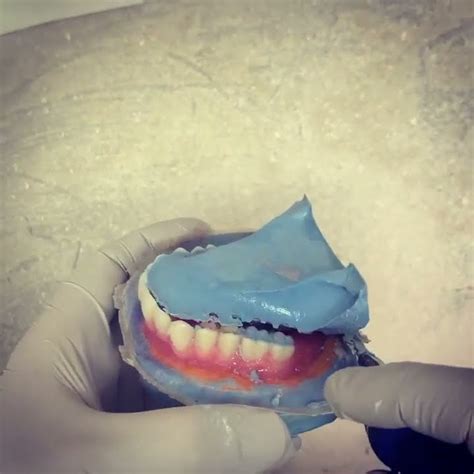 Deflasking A Denture Youtube
