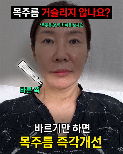 아이백 볼륨 리프팅 개선 임상 완료 📌변정수 Pick 닥터멜락신 아이팔트 눈 밑을 근본적으로 개선해주는 아이크림 등장 도포 후 1분이면 아이백이 사라집니다 8시간