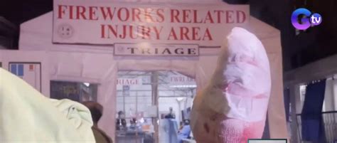 Doh Records 51 More Fireworks Related Injuries 1 Stray Bullet Victim