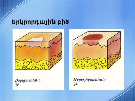 Անատոմիա ֆիզիոլոգիա թարախաբշտիկային հիվանդություններ պարազիտար հիվ…