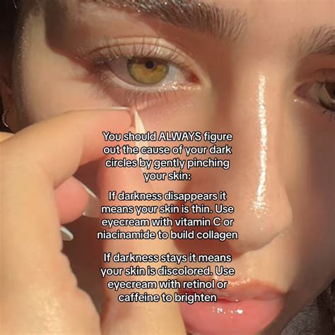How To Get Rid Of Dark Circles Wrinkles Bags Under Eyes Artofit