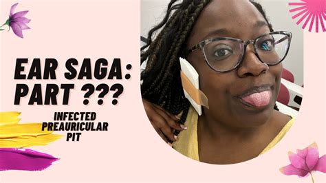 Im Getting Surgery Preauricular Pit Youtube
