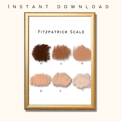Fitzpatrick Scale Postera4a3a1 Digital Print Etsy