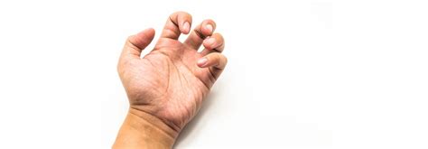 Spasticity Nerveaide Rehabilitation Systems