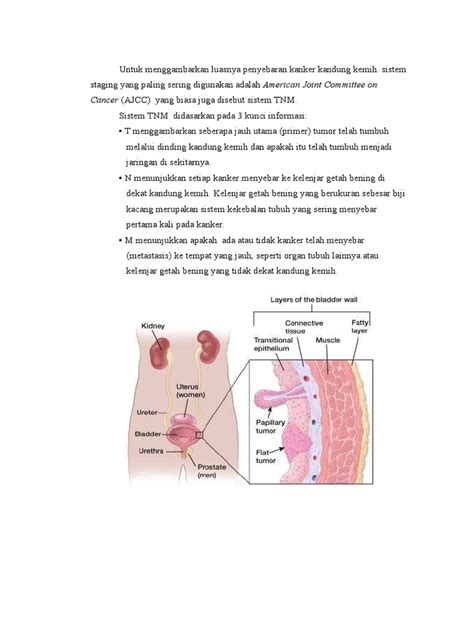 Staging Kanker Kandung Kemih Sistem Tnm Dan Tahapan Penyakit Pdf