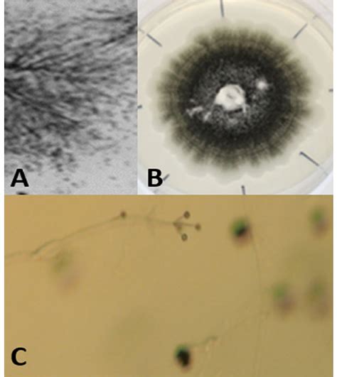 A Verticillium Dahliae Dar85139 Showing Characteristic Starburst Download Scientific Diagram